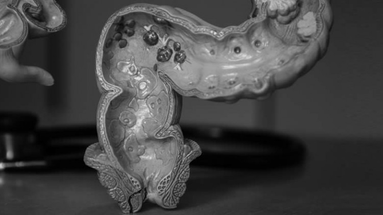 Proktologie - Schwerpunktpraxis Magen Darm Leber Aachen Nord